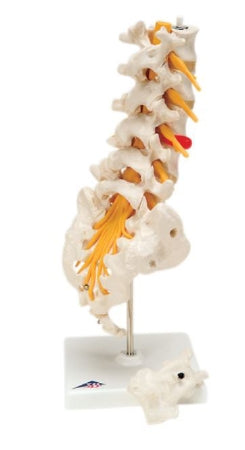 3B - Anatomical Model Prolapsed Lumbar Section 3 lbs. - 12-4543 ...