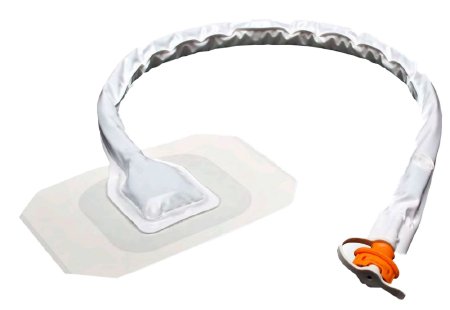 Renasys - Stand Alone Soft Port Kit - 66800799 — Serfinity Medical