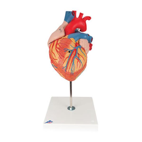 American 3B Heart Model Anatomical 2 Times Life Size/ 4-Part Ea - Z130 ...