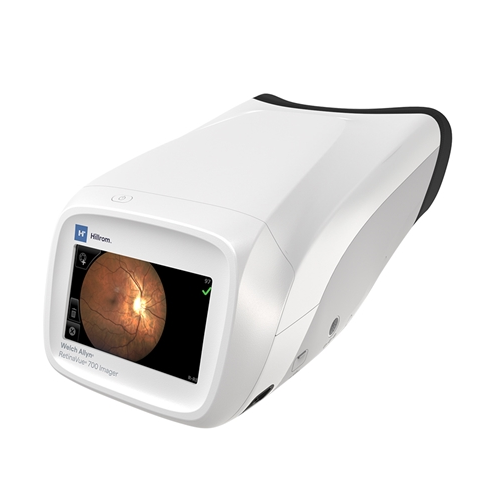 Welch Allyn RetinaVue 700 Imager, Diabetic retinopathy screening - RV7 ...